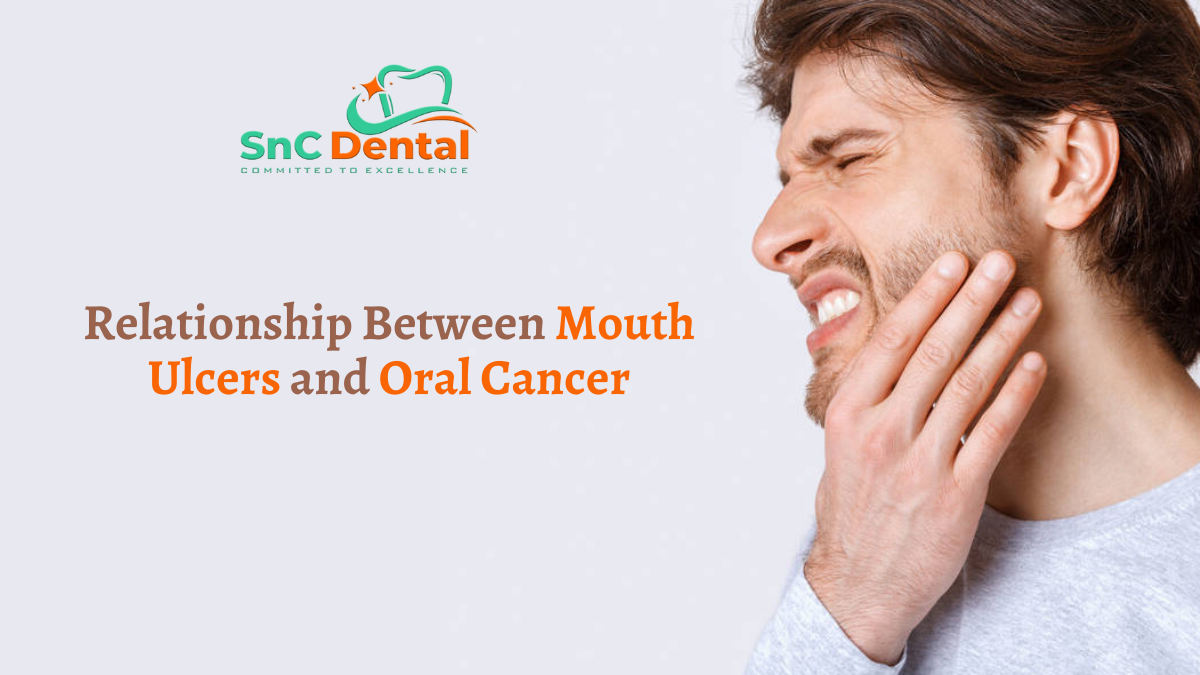 Mouth Ulcer Specialist Doctor | Mouth ulcers and Oral Cancer